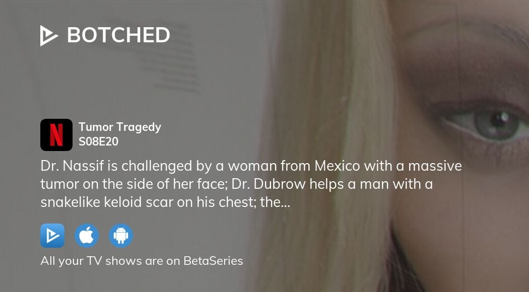Watch Botched season 8 episode 20 streaming